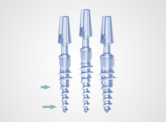 TPG Implants – Osseo Dont Implant